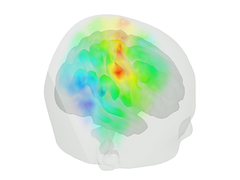 Motor cortex | List of publications using Artinis Near Infrared ...